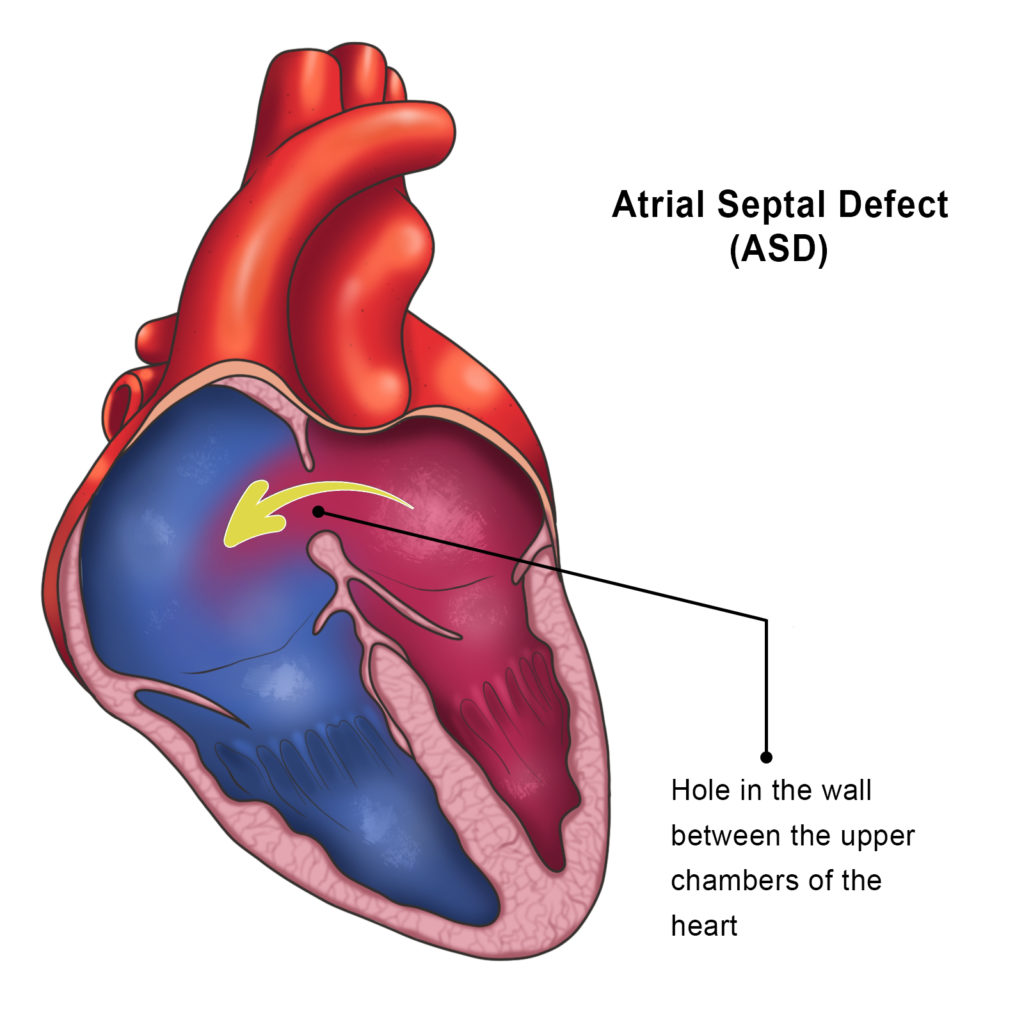 Time to pay attention to congenital heart defects - News From Ben's Friends