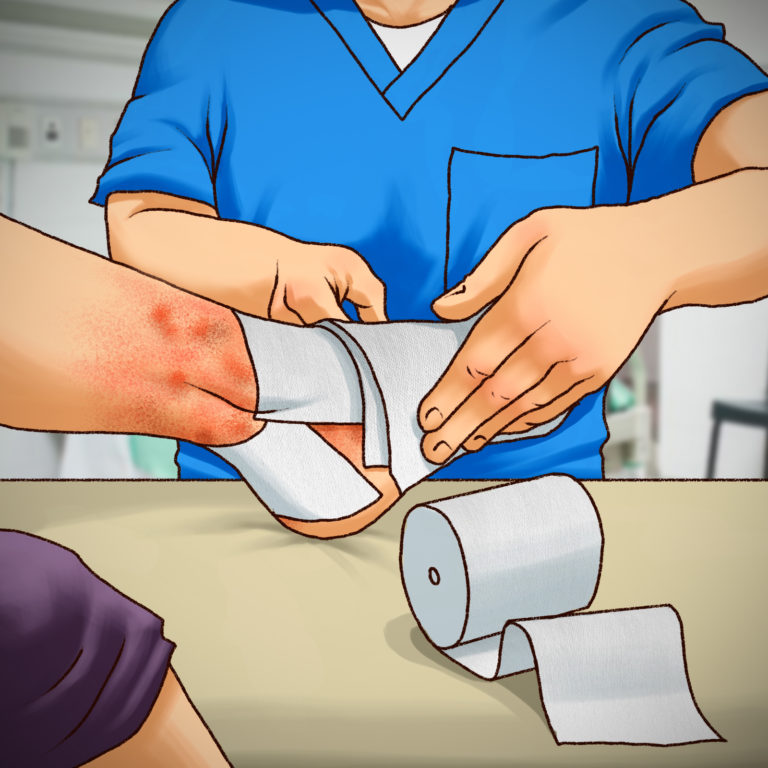 Butterfly Skin Unmasked: The Challenge of Living with Epidermolysis ...